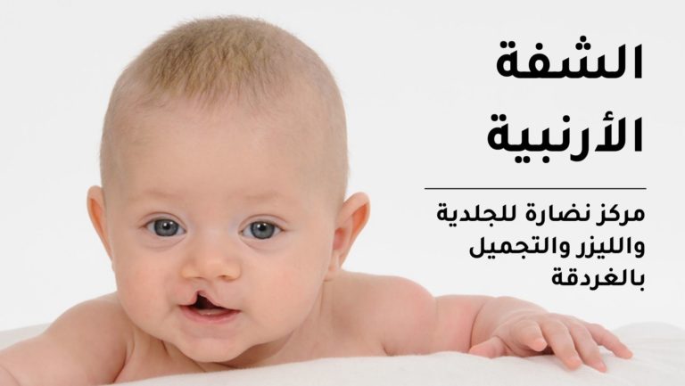 Rabbit lip - freshness center for dermatology, laser and cosmetology in ...