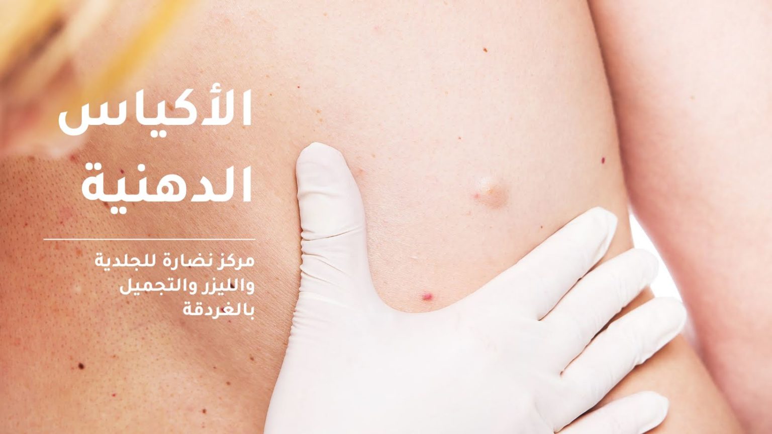 Fat bags - freshness center for dermatology, laser and cosmetology in ...