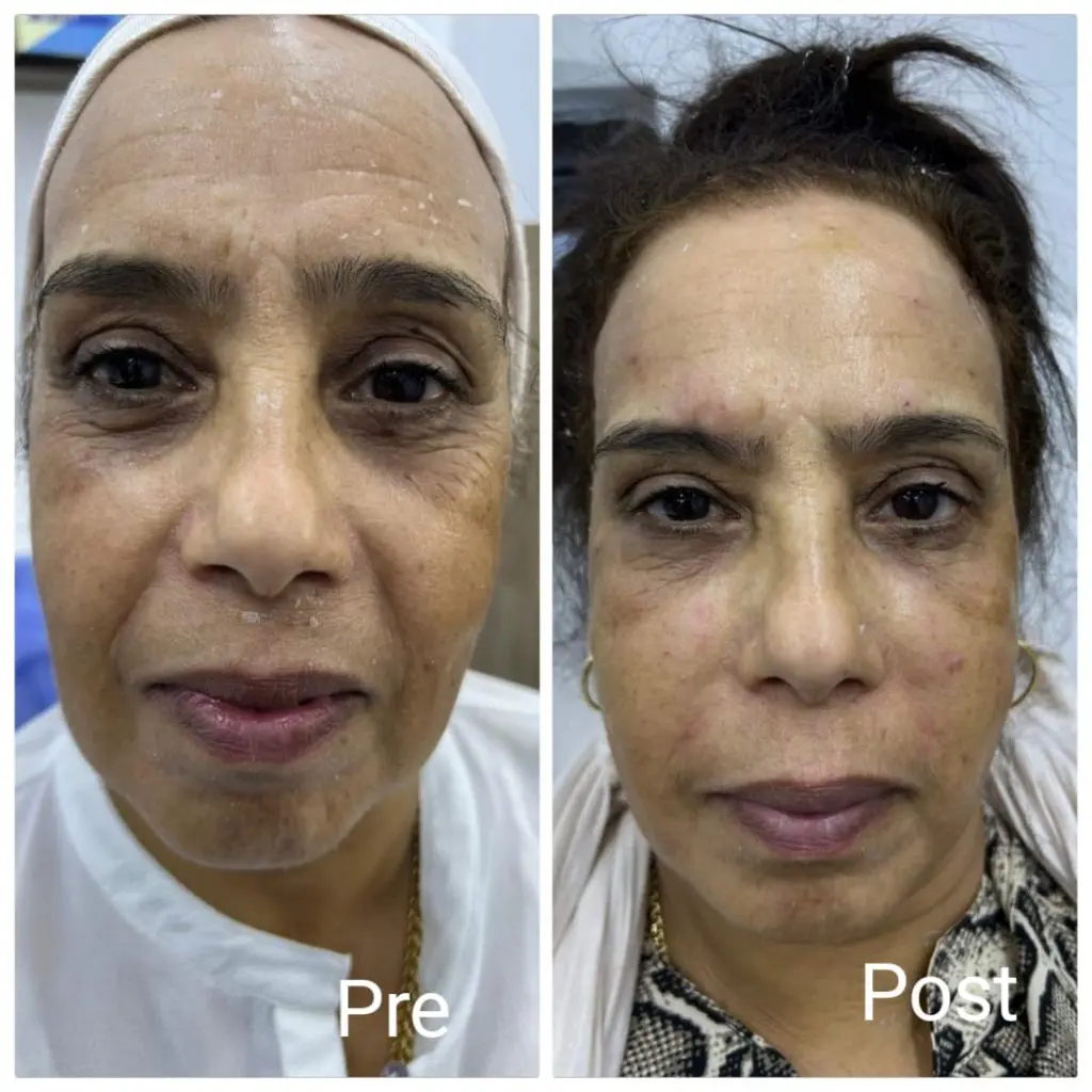 Medical Spa In Hurghada Book Now Nadara Clinic