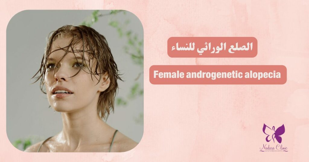 Female Androgenetic Alopecia In Hurghada Book Now Nadara